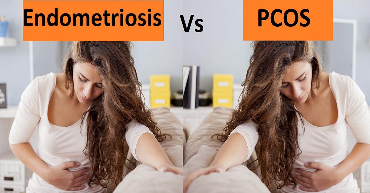 Endometriosis vs. PCOS: How to tell the difference
